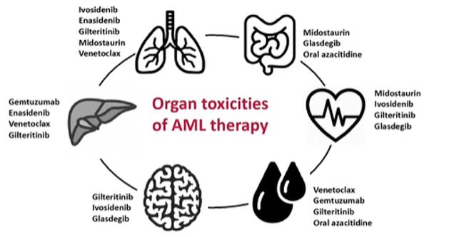 Acute Myeloid Leukemia (AML): Highlights from ASH 2020 – ALAN